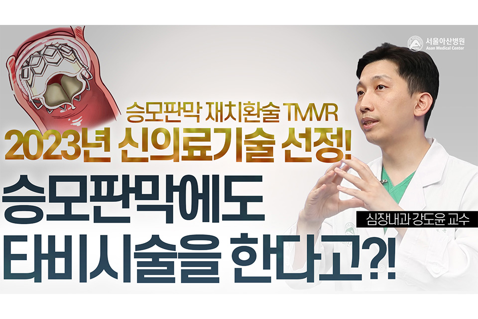 건강정보2023년 신의료기술 승인된 심장 시술방법은 승모판막 재치환술 새소식·공지 일반인정보 심장병원 서울아산병원